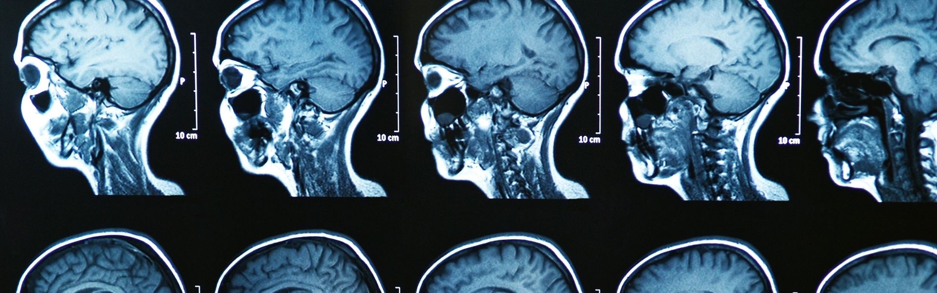 Brain Balance Therapy & Assessment Services - Dr. Kelly Miller